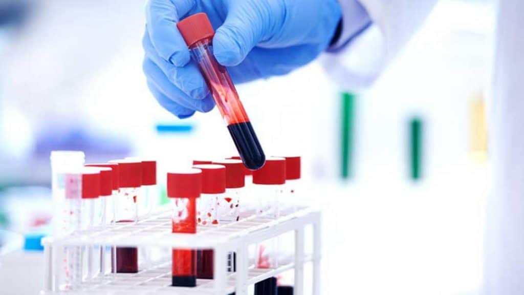 آزمایش شمارش گلبول سفید خون (WBC) چیست؟ - درمانکده